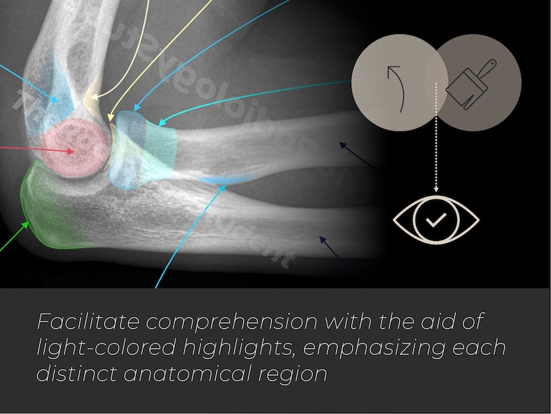 Elbow X-ray Anatomy | Radiology Study Guide for Rad Tech - Etsy