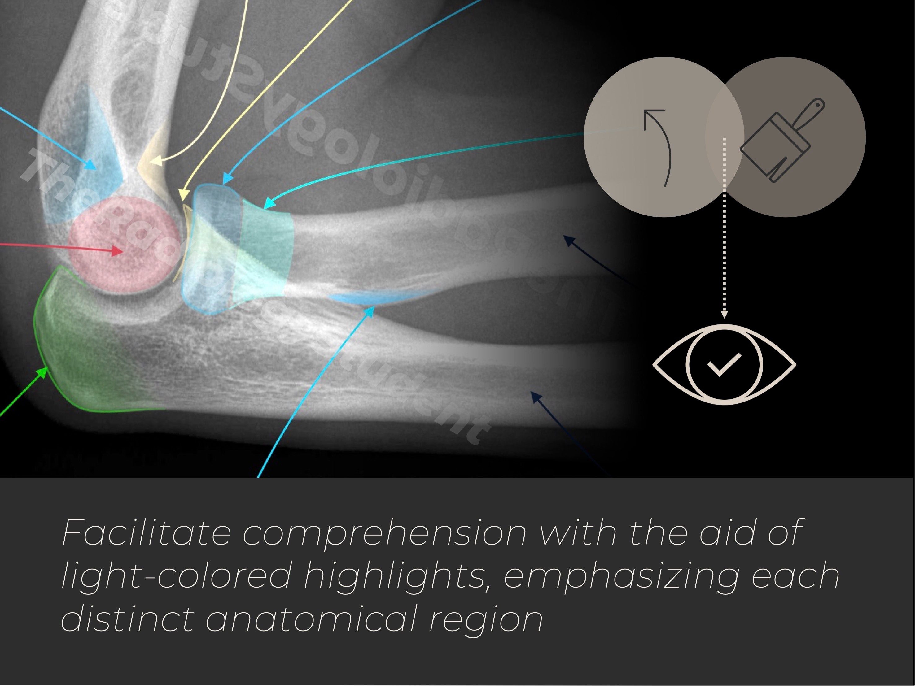 Elbow X-ray Anatomy | Radiology Study Guide for Rad Tech - Etsy