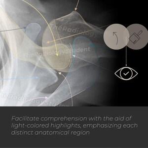 Shoulder X-rays Anatomy Quiz | Study Guide for Radiology Student - Etsy