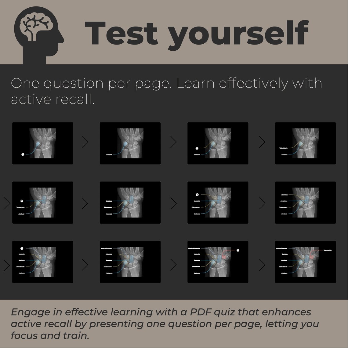 Hand and Wrist X-ray - Radiology Anatomy Quiz - Study Materials for ...