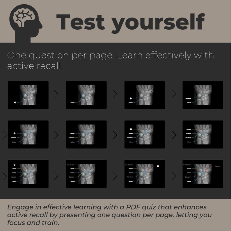 Hand and Wrist X-ray - Radiology Anatomy Quiz - Study Materials for ...