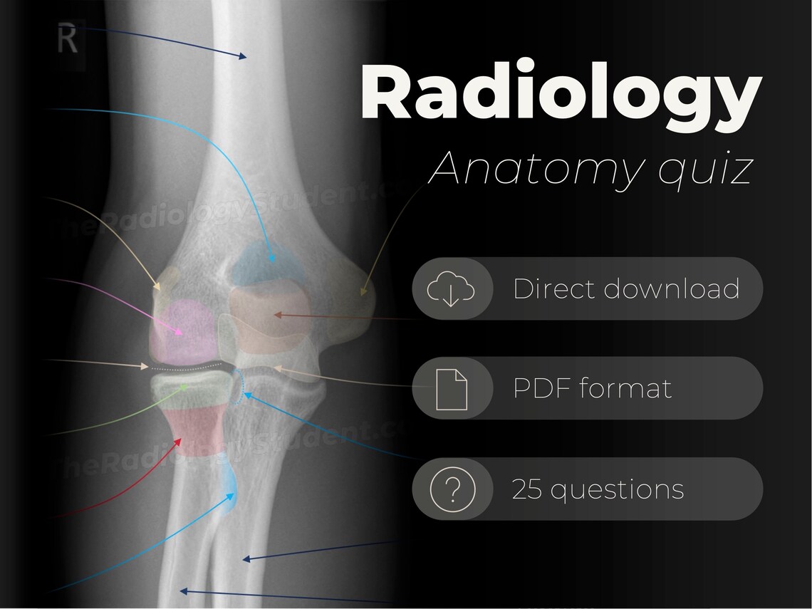 Elbow X-ray Anatomy | Radiology Study Guide for Rad Tech - Etsy