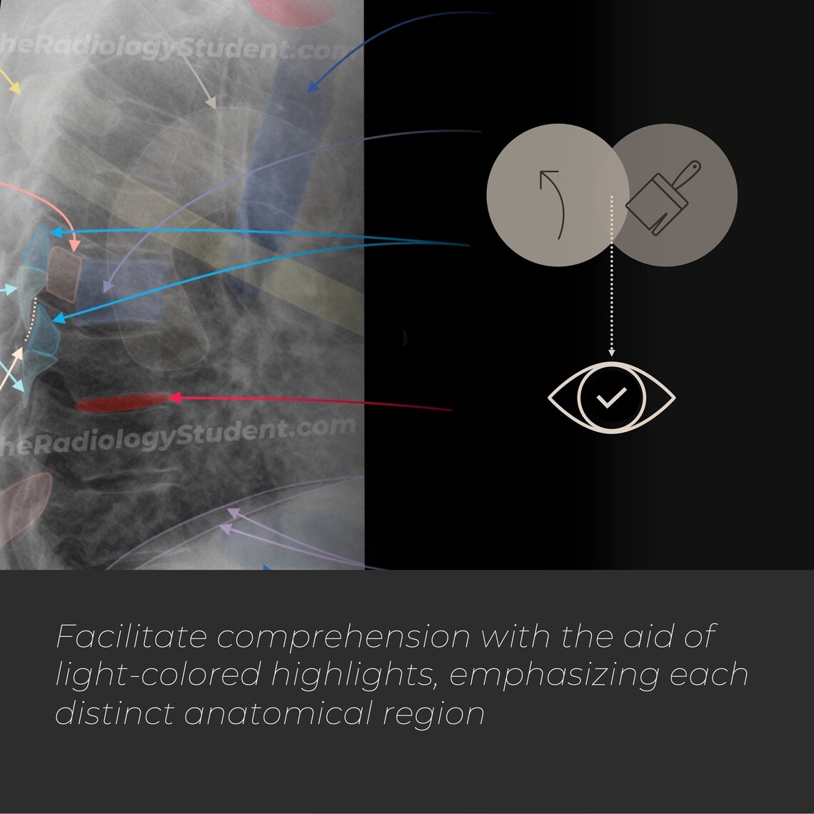 Thoracic Spine Xray Anatomy | Neck Bones and Joint Quiz | Radiology ...