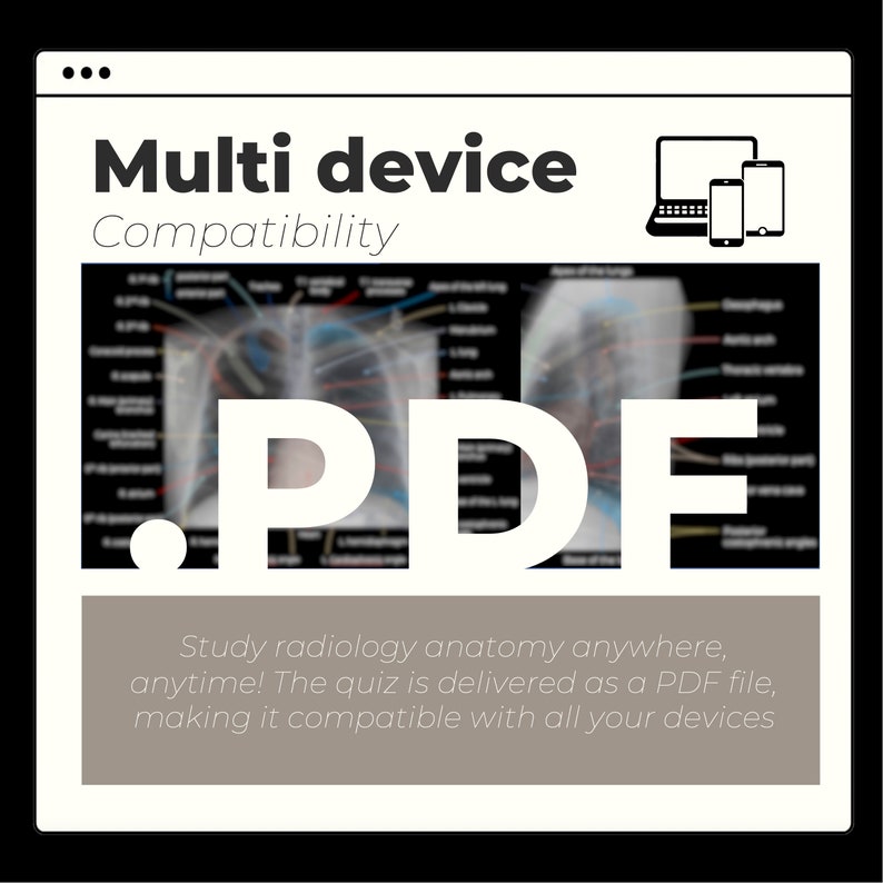 Chest X-ray Anatomy | Labelled Radiography Notes - Etsy