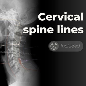 Cervical Spine X-ray Anatomy Quiz | Diagnostic Radiology Study Guide ...