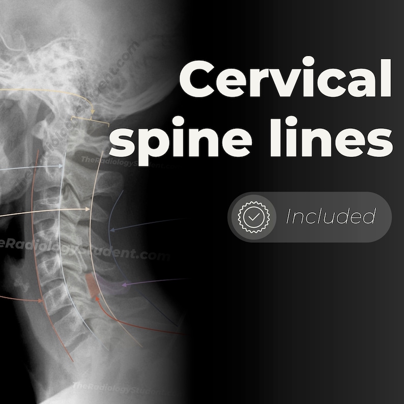 Cervical Spine X-ray Anatomy Quiz | Diagnostic Radiology Study Guide ...