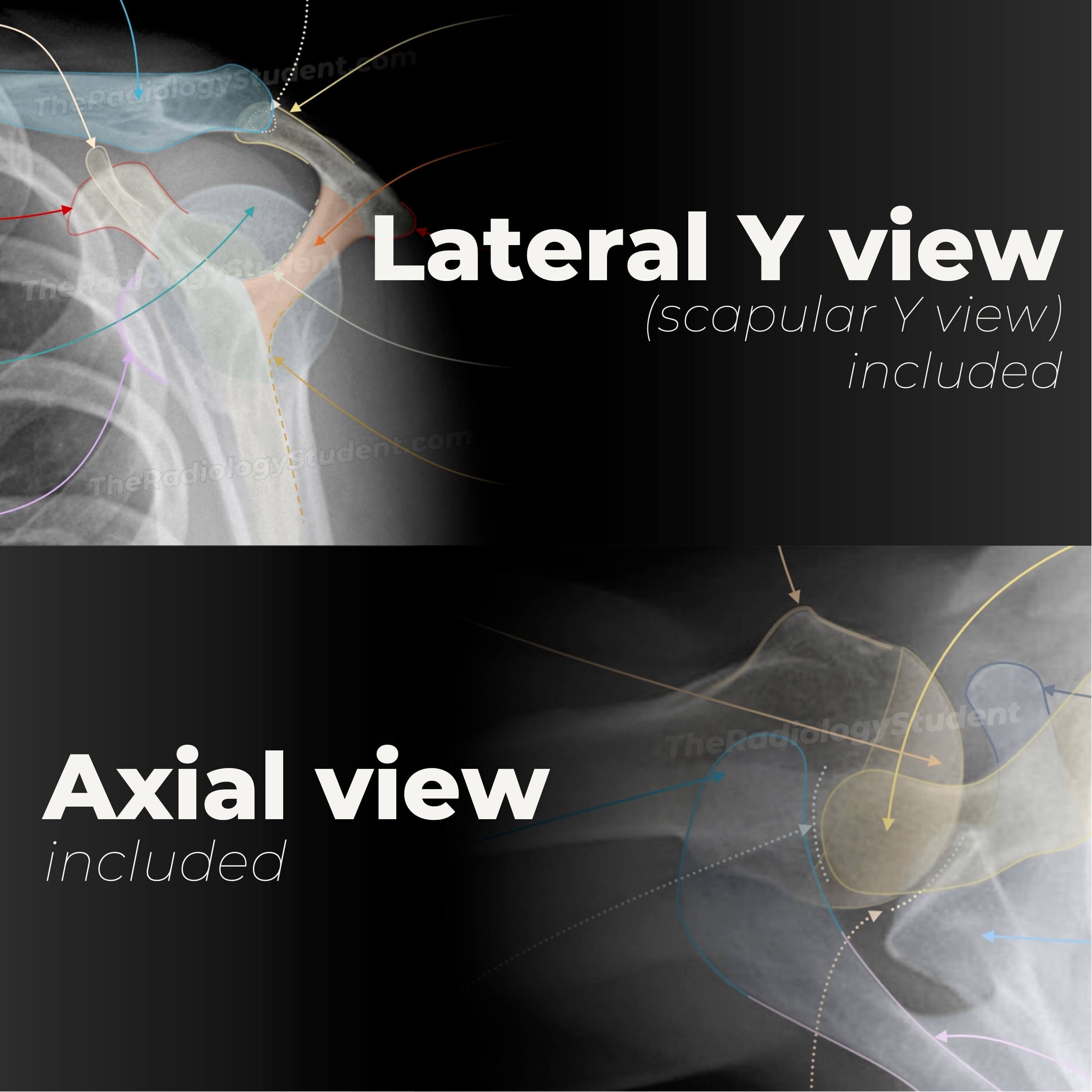 Shoulder X-rays Anatomy Quiz | Study Guide for Radiology Student - Etsy