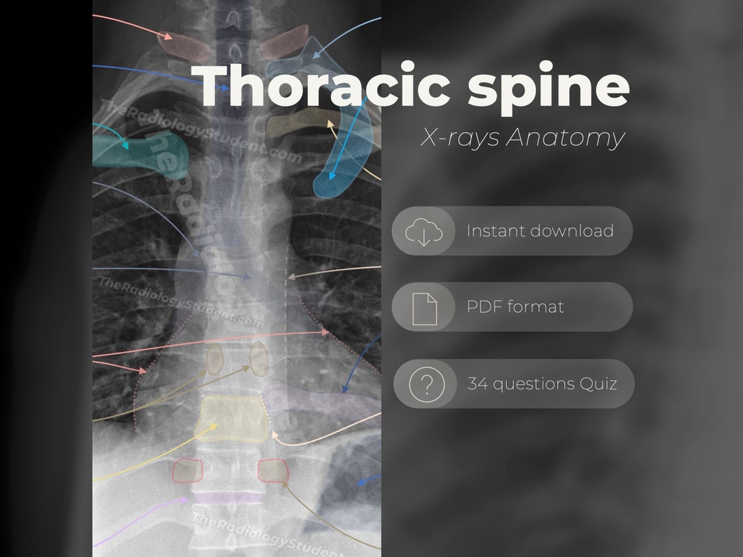 Thoracic Spine Xray Anatomy | Neck Bones and Joint Quiz | Radiology Student Study Guide - Etsy