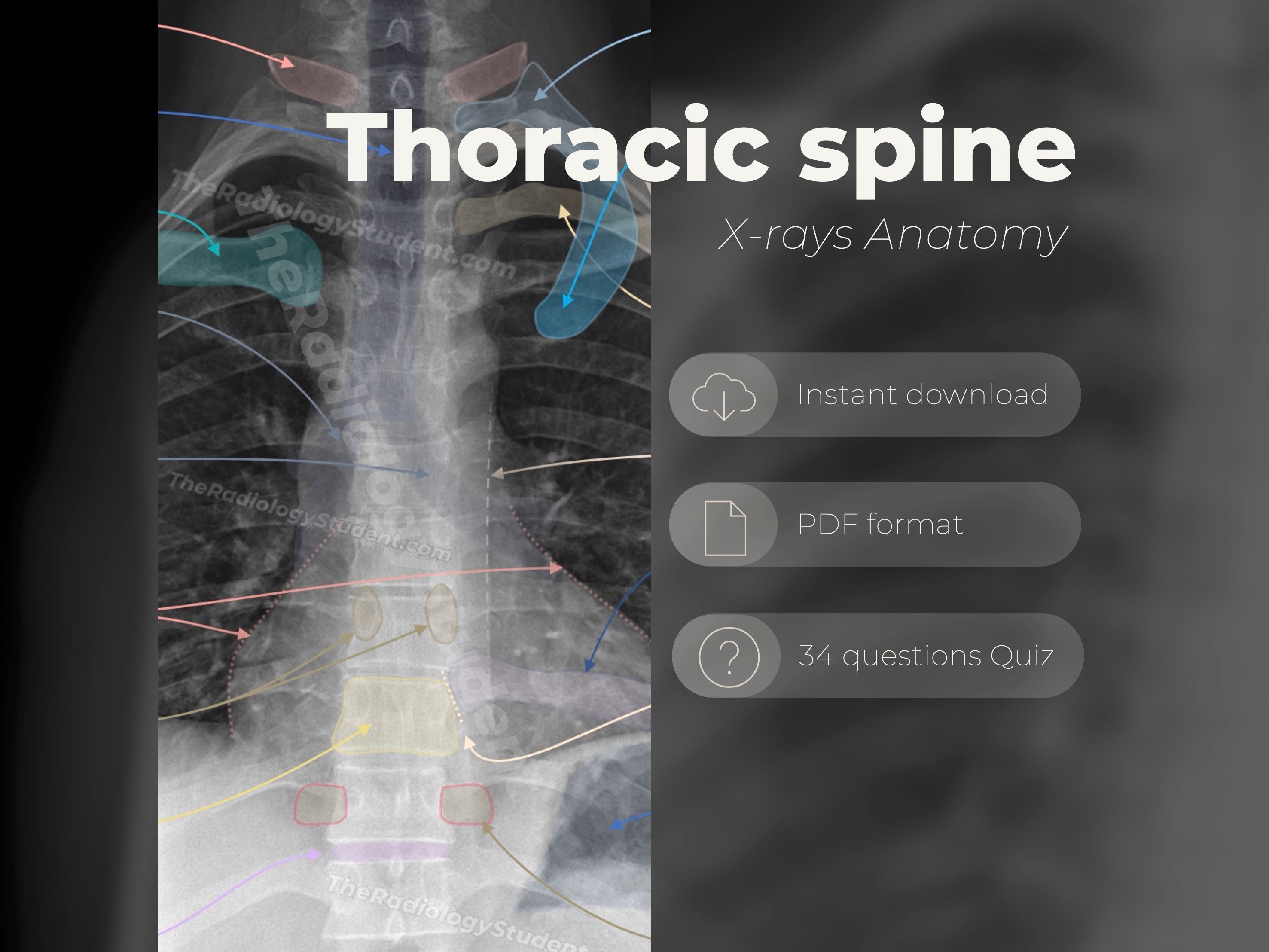 Thoracic Spine Xray Anatomy | Neck Bones and Joint Quiz | Radiology ...
