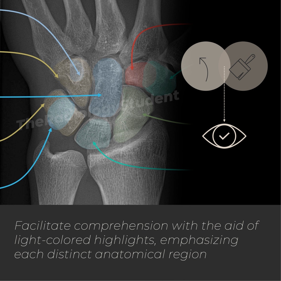 Hand and Wrist X-ray - Radiology Anatomy Quiz - Study Materials for ...