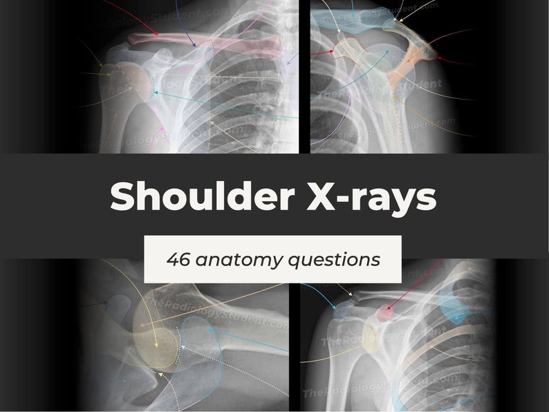 Shoulder X-rays Anatomy Quiz | Study Guide for Radiology Student - Etsy