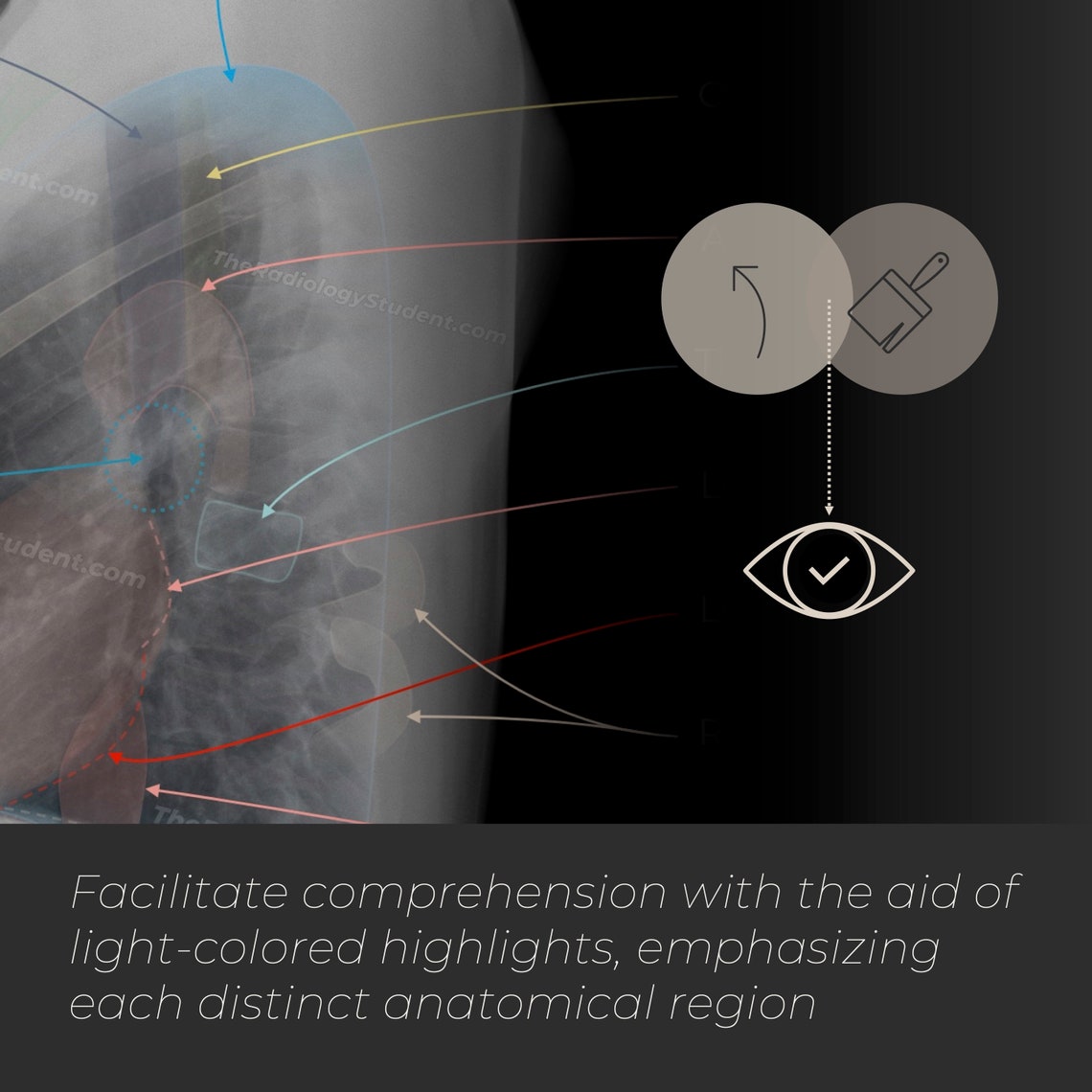 Chest X-ray Anatomy | Labelled Radiography Notes - Etsy