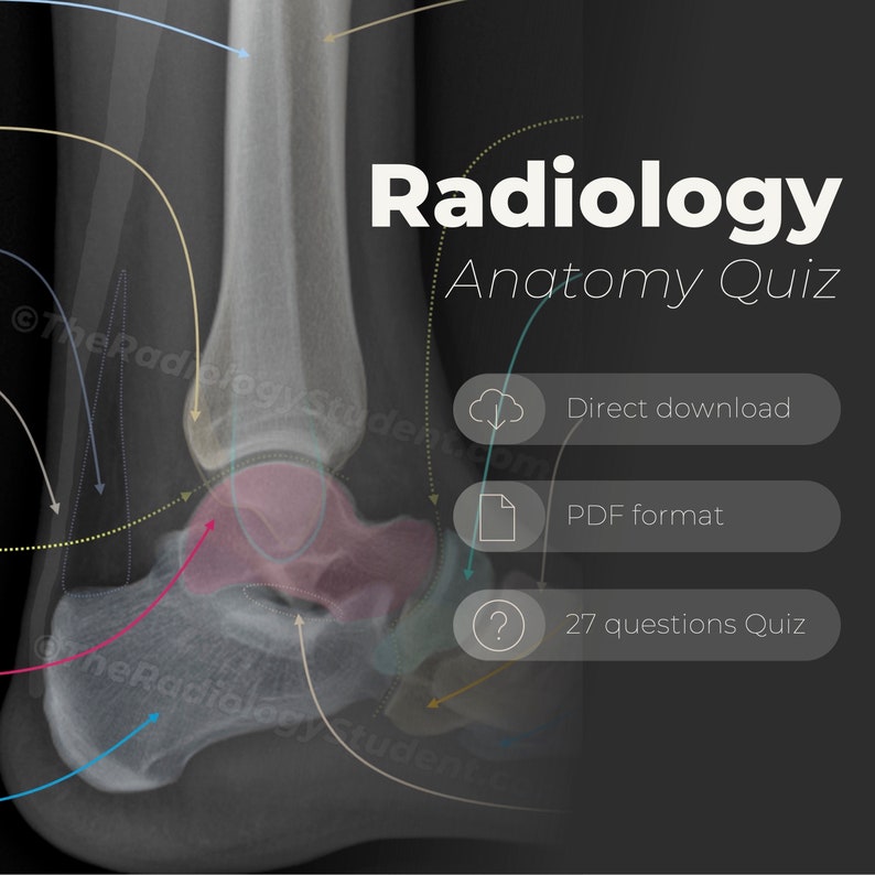Ankle Xrays Annotated - Labeled Quiz to Learn Radiology Anatomy - Etsy