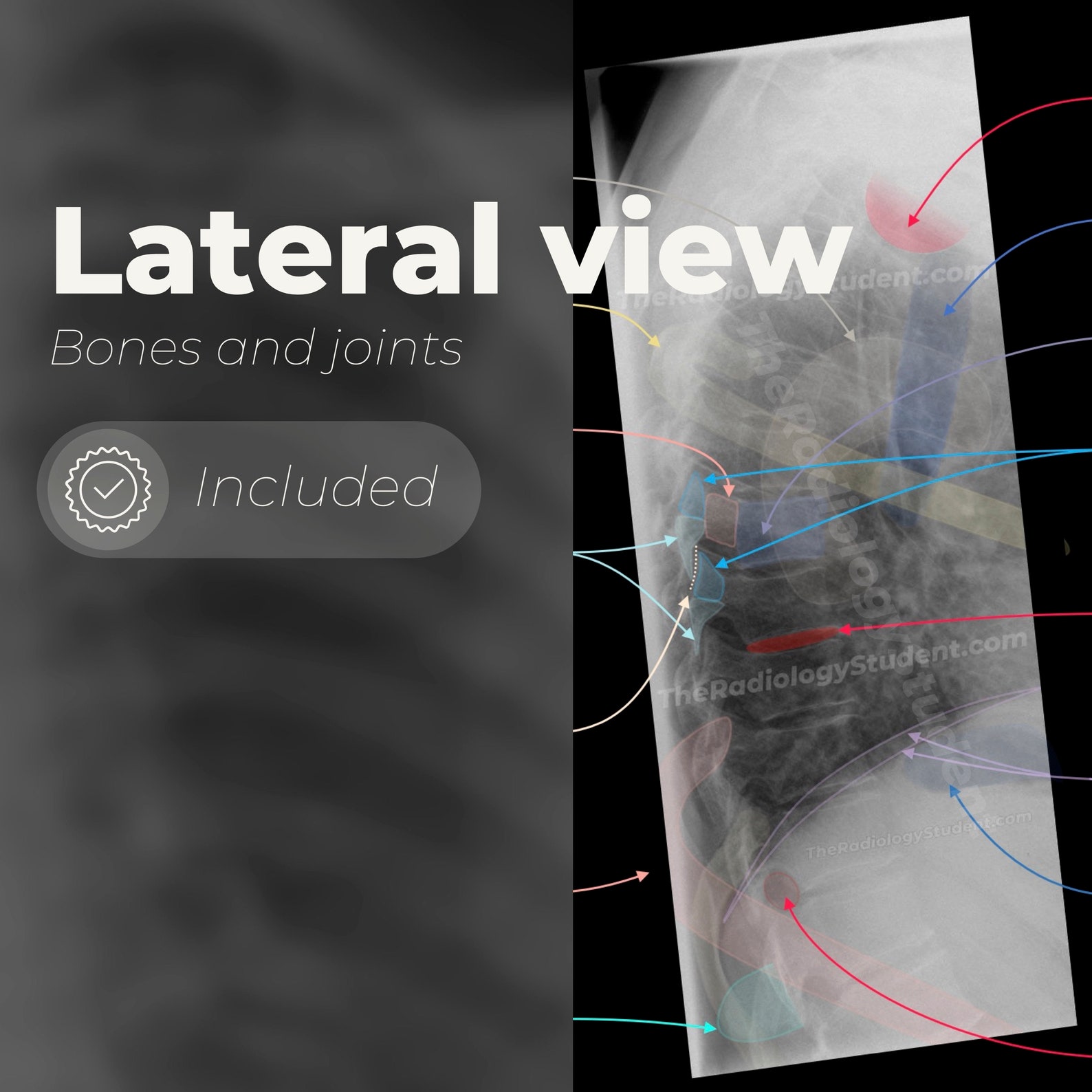 Thoracic Spine Xray Anatomy | Neck Bones and Joint Quiz | Radiology ...