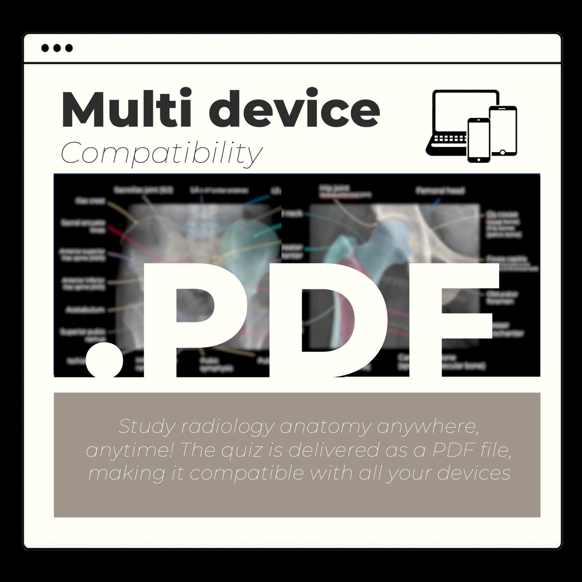Cervical Spine X-ray Anatomy Quiz | Diagnostic Radiology Study Guide ...
