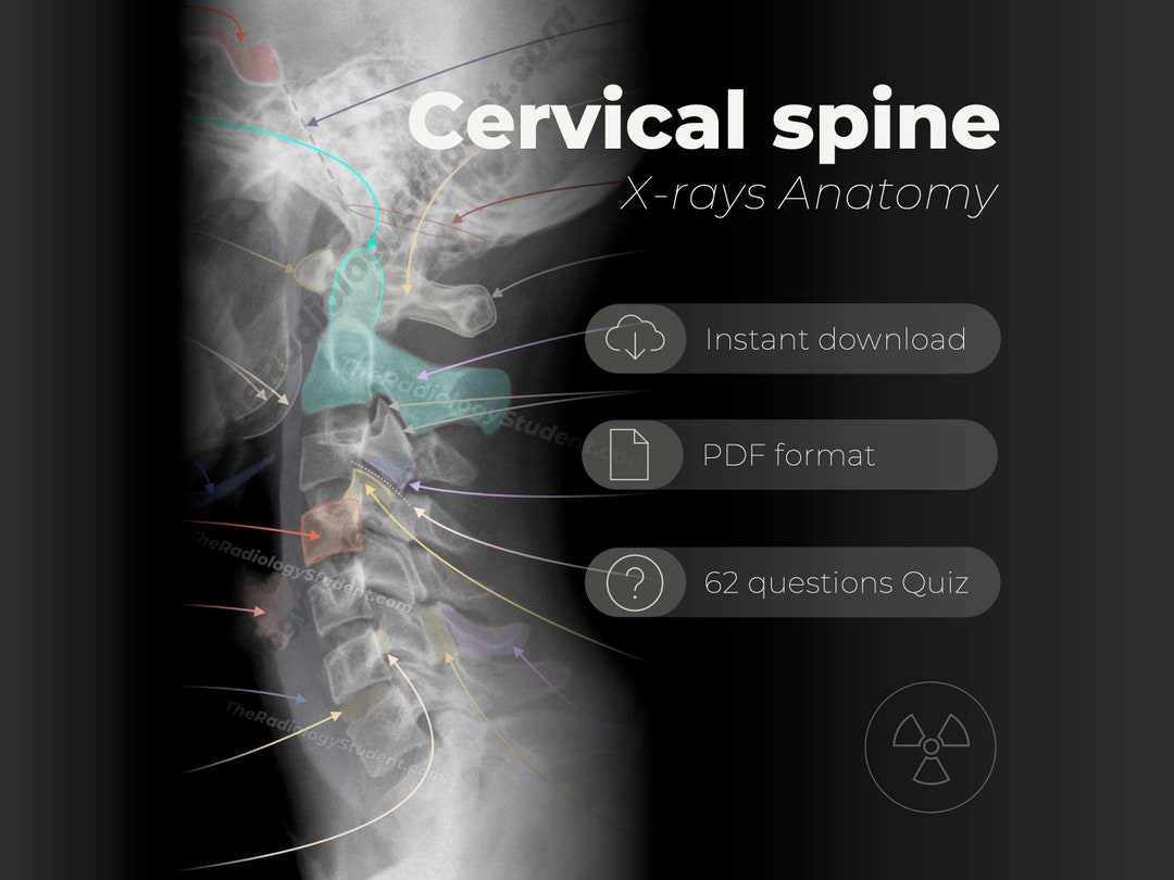 Cervical Spine X-ray Anatomy Quiz | Diagnostic Radiology Study Guide ...