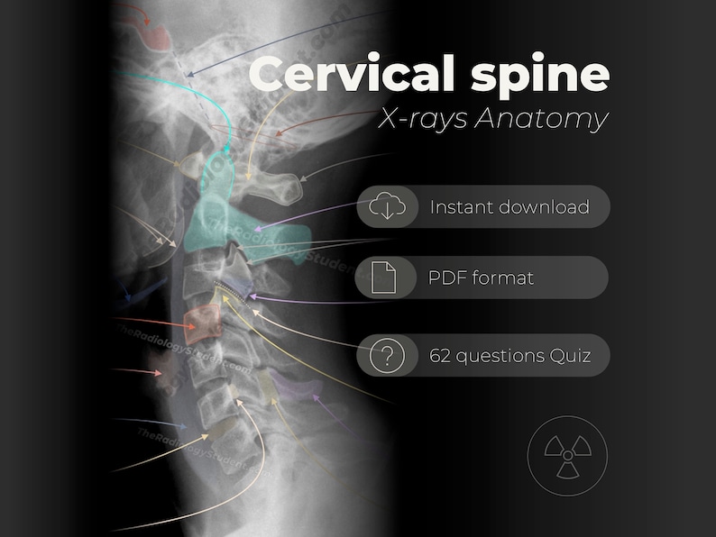 Cervical Spine X-ray Anatomy Quiz | Diagnostic Radiology Study Guide for Radiographer Student - Etsy