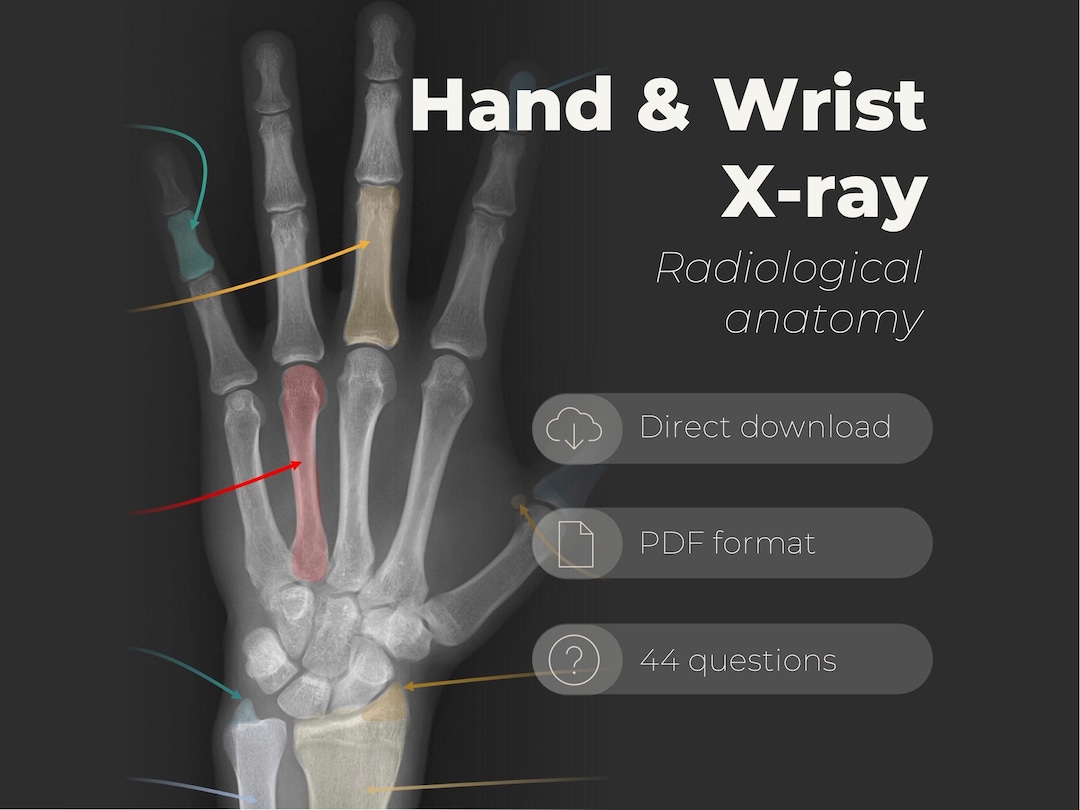 Hand and Wrist X-ray - Radiology Anatomy Quiz - Study Materials for ...