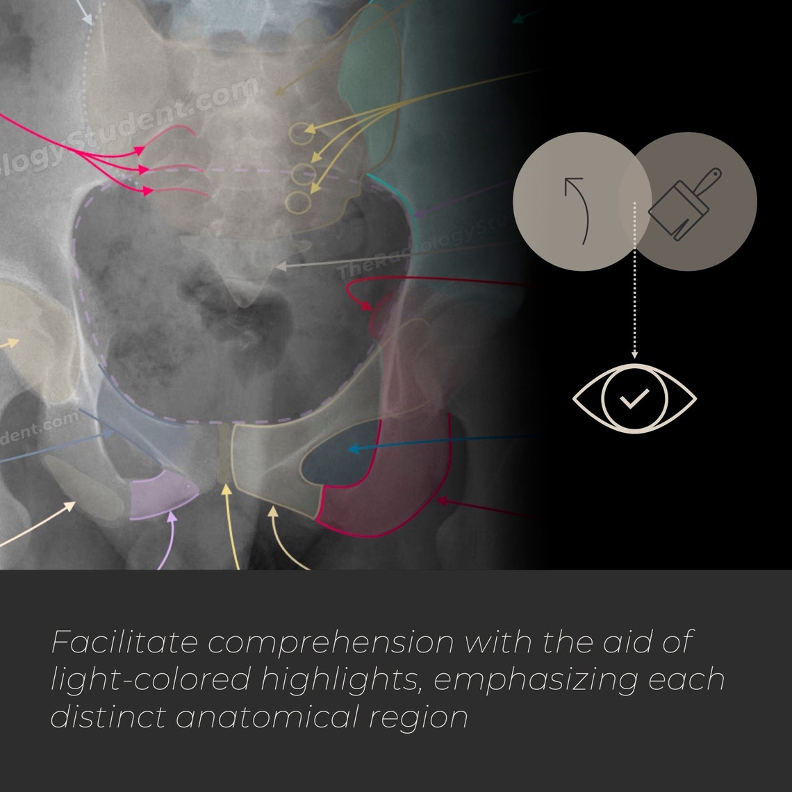 Pelvis & Hip Xray Anatomy Quiz | Study Material for Radiology ...