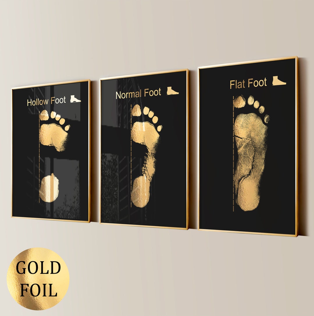 3 Gold Footprint Types Art, Anatomy Art, Foot Pathologies, Foot Arch ...