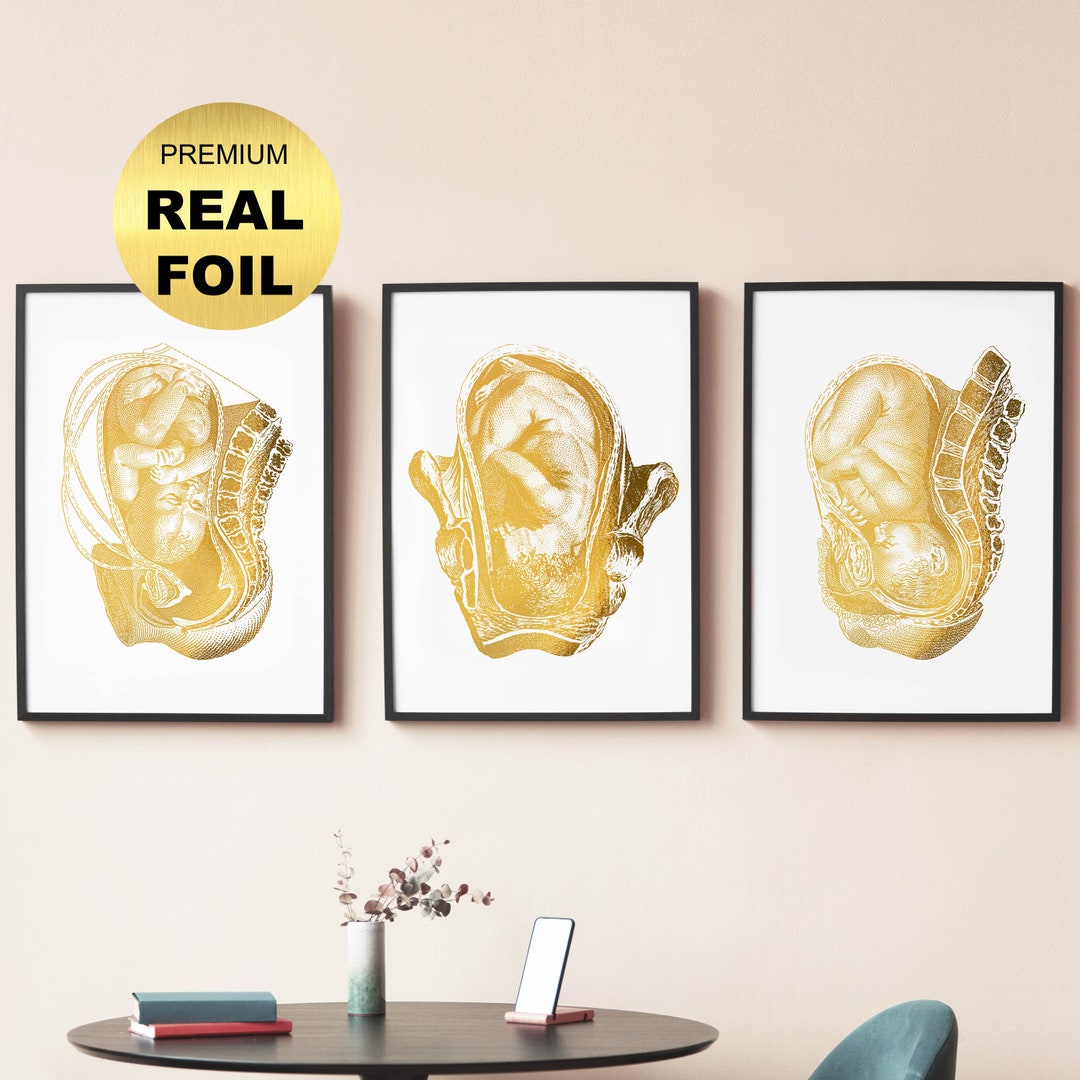 Midwife Gift Pregnancy Art Anatomy Art Fetus in Womb Art Fetal ...