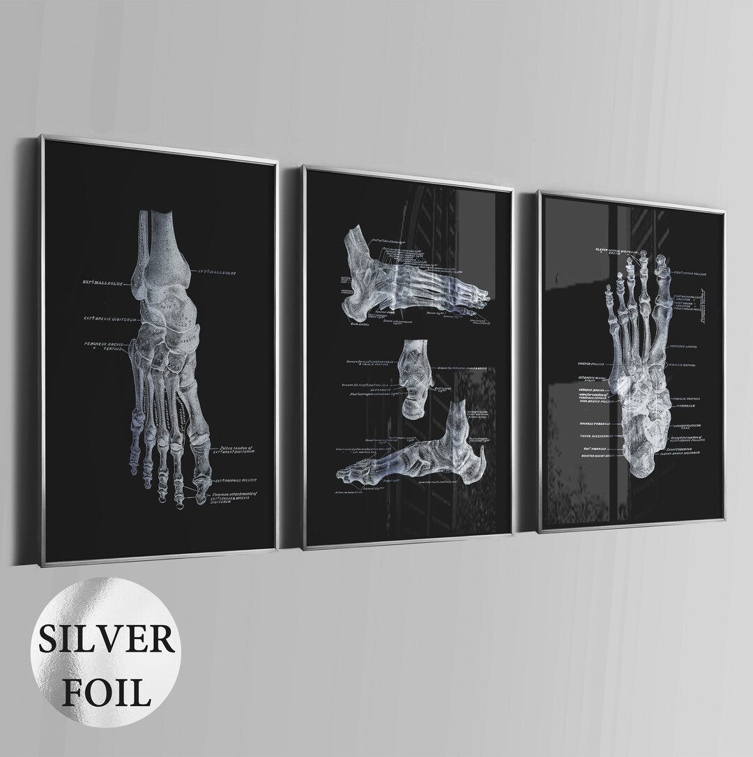 Set 3 Foot Anatomy Posters Orthopedic Art Medical Art Orthopedist Gift ...