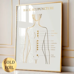 3 Acupuncture Therapy Posters Reflexology Art Alternative Medicine Art ...