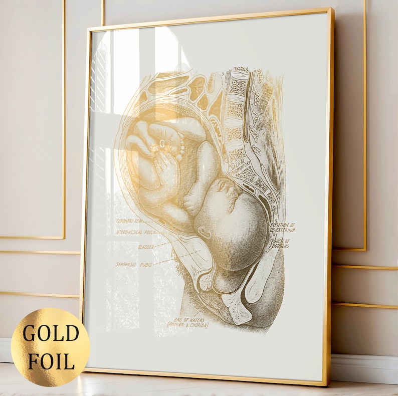 3 Female Anatomy Art Pregnancy Art Medical Art Fetus Poster Uterus ...