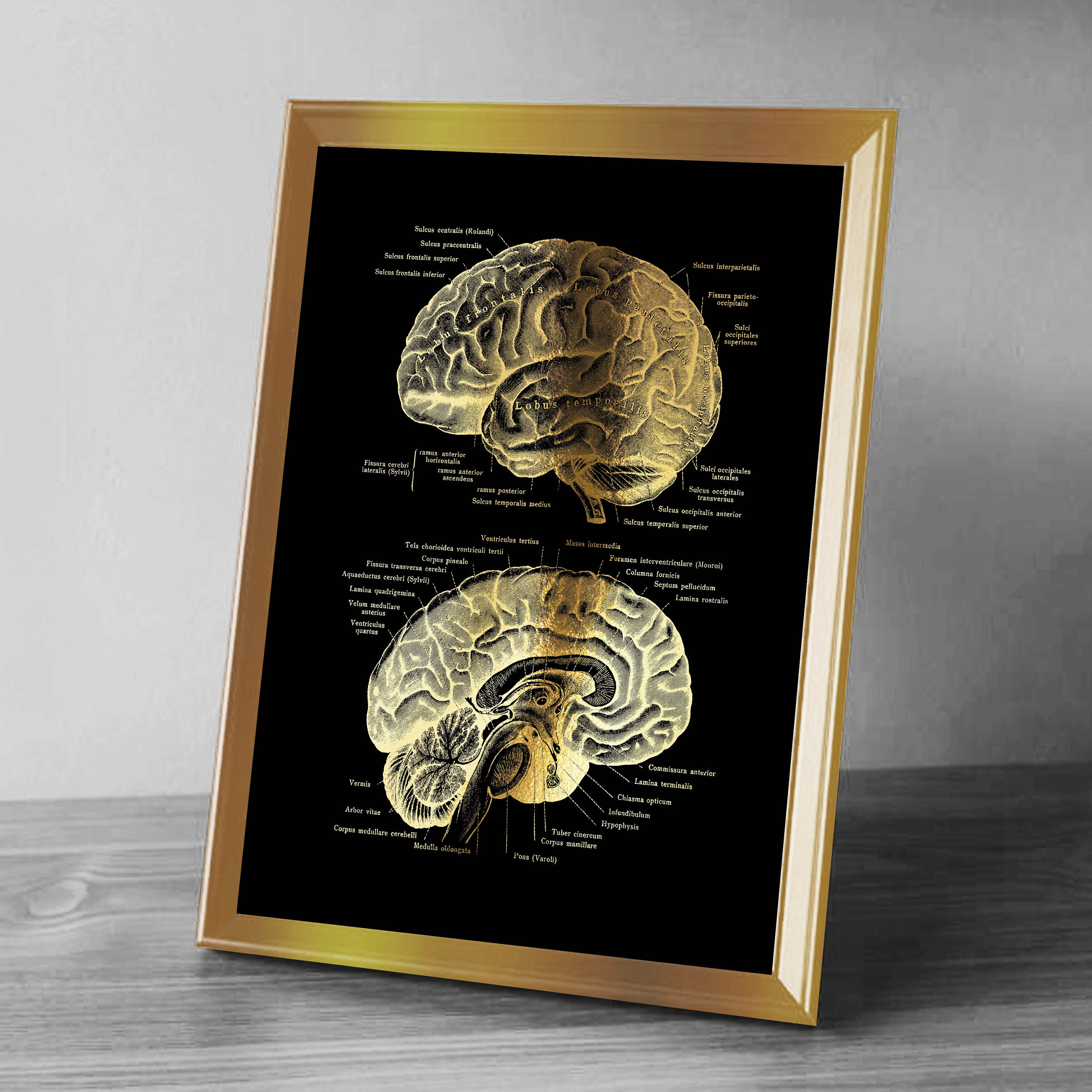 Gold Brain Anatomy Art Neurology Art Medical Art Neurologist Art ...
