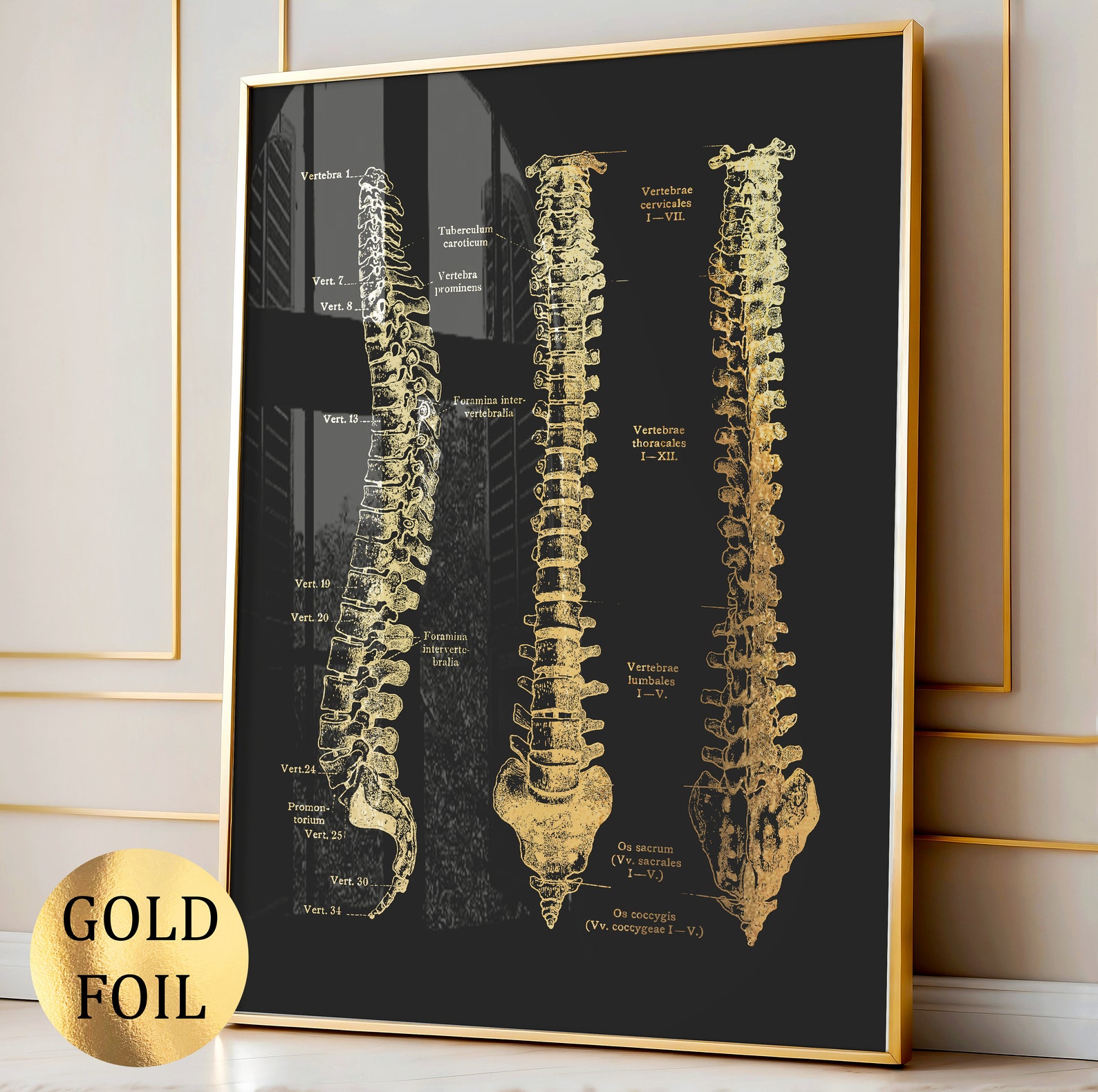 6 Spine Vertebral Column Anatomy Art Vertebrae Poster Spinal Diagram ...