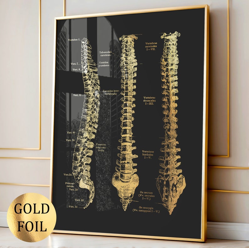 6 Spine Vertebral Column Anatomy Art Vertebrae Poster Spinal Diagram ...