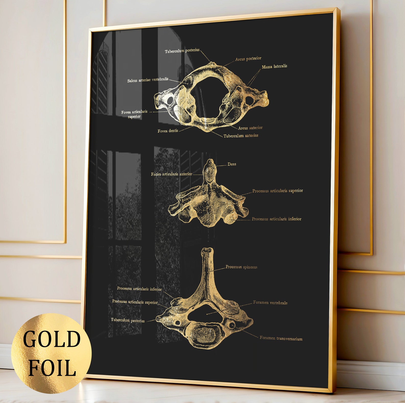 6 Spine Vertebral Column Anatomy Art Vertebrae Poster Spinal Diagram ...