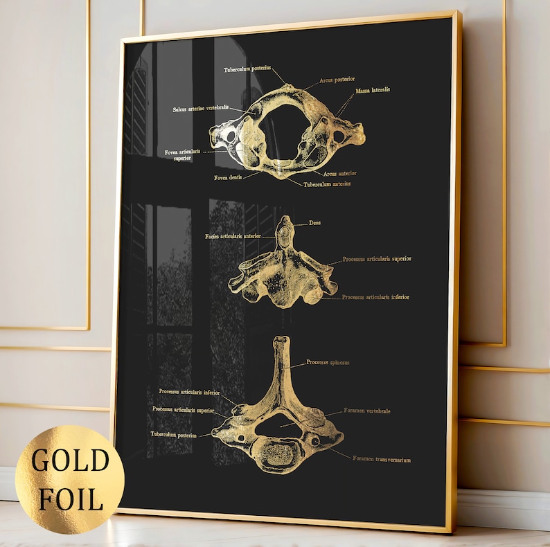 6 Spine Vertebral Column Anatomy Art Vertebrae Poster Spinal Diagram ...