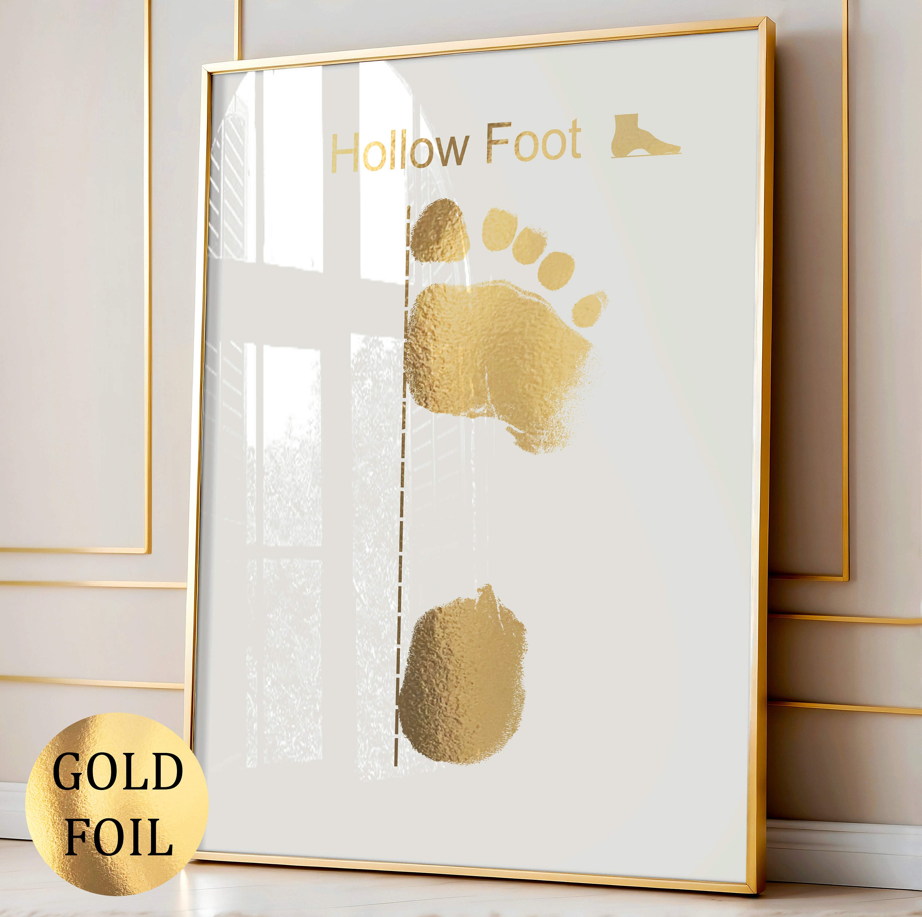 Set 3 Gold Footprint Types Posters Anatomy Art Foot Pathologies Foot ...