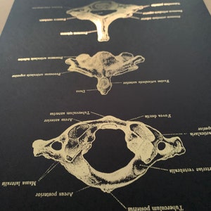 6 Spine Vertebral Column Anatomy Art Vertebrae Poster Spinal Diagram ...