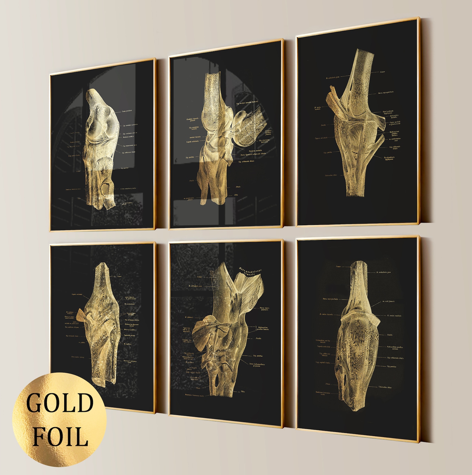 6 Knee Anatomy Art Orthopedic Art Knee Joint Posters Physiotherapy Art ...