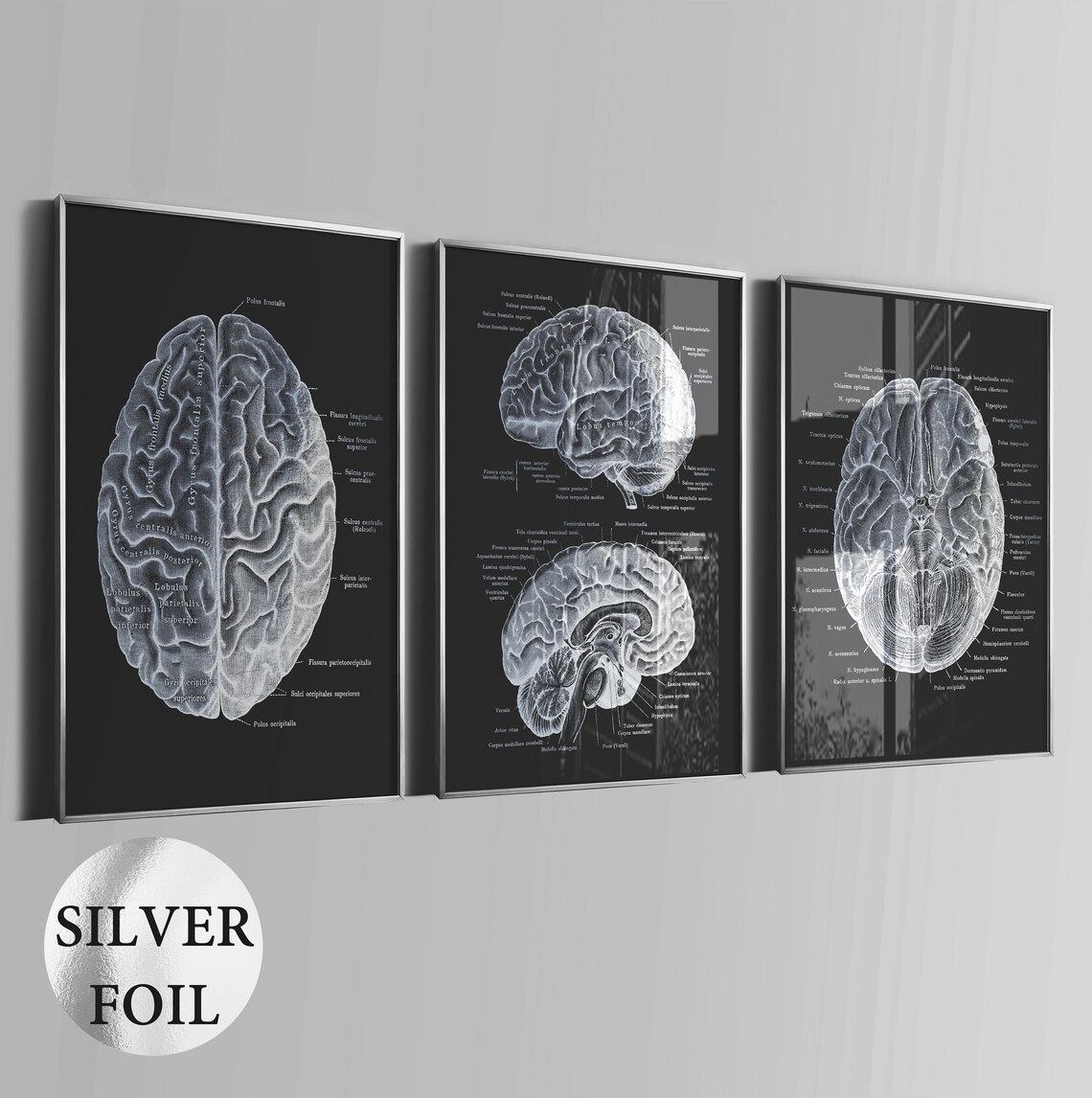3 Anatomical Brain Posters Neurology Art Neuroscience Art Medical Art ...