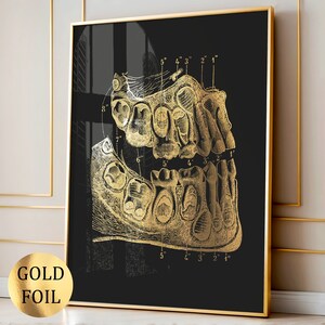 Set 6 Dental Anatomy Art Tooth Poster Teeth Numbering Diagram Dentist ...