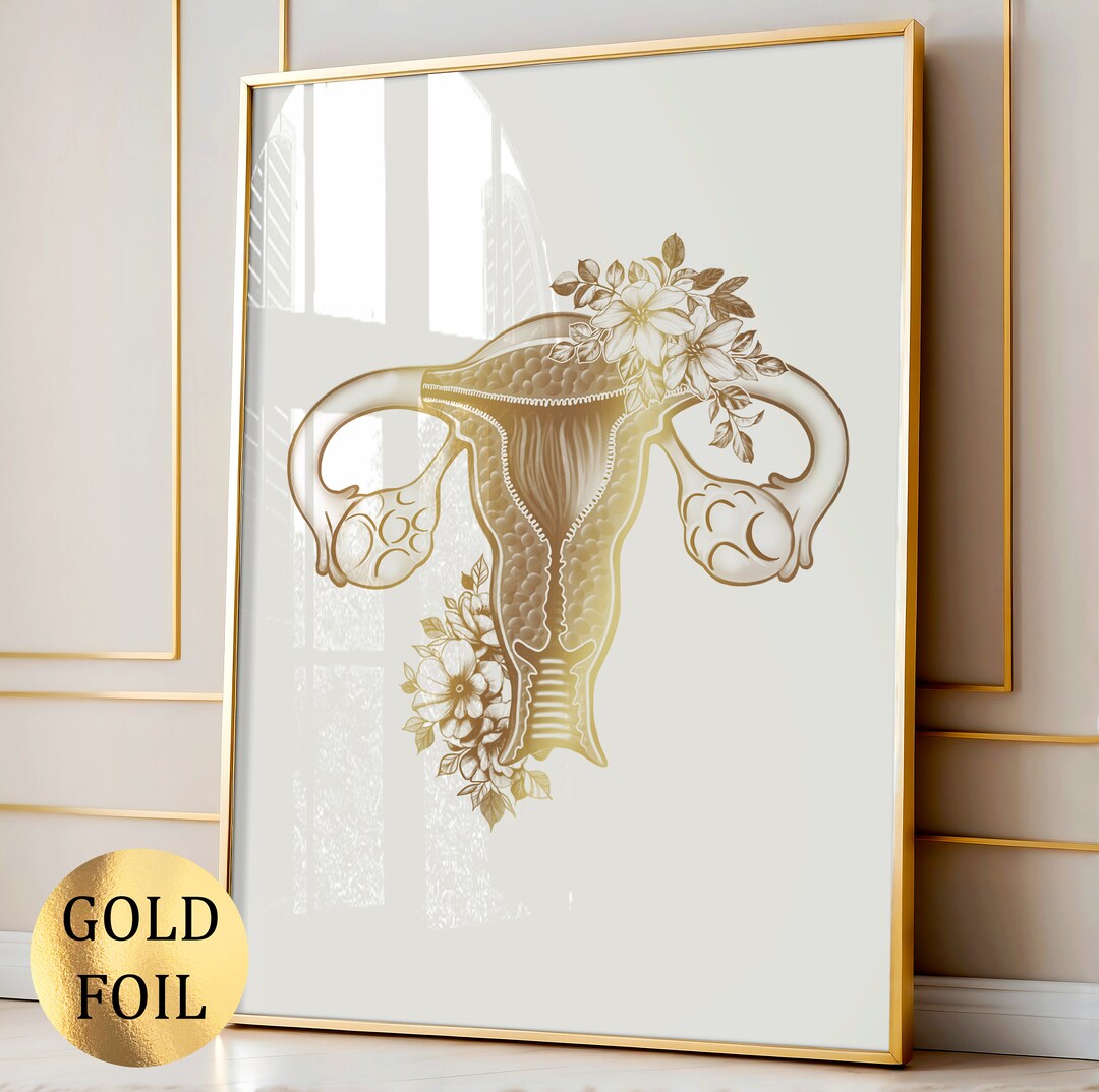 Uterus Art Gold Anatomy Art Medical Art Reproductive System Poster Obgyn Art Gynecology Clinic