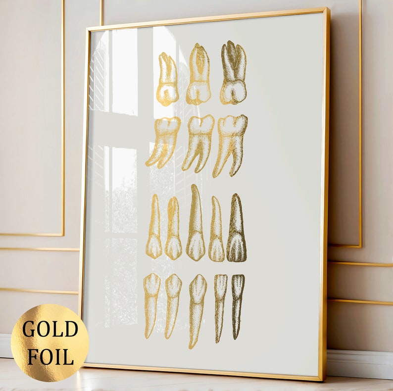 Tooth Anatomy Art, Gold Anatomy Poster, Dental Art, Dentistry Art ...