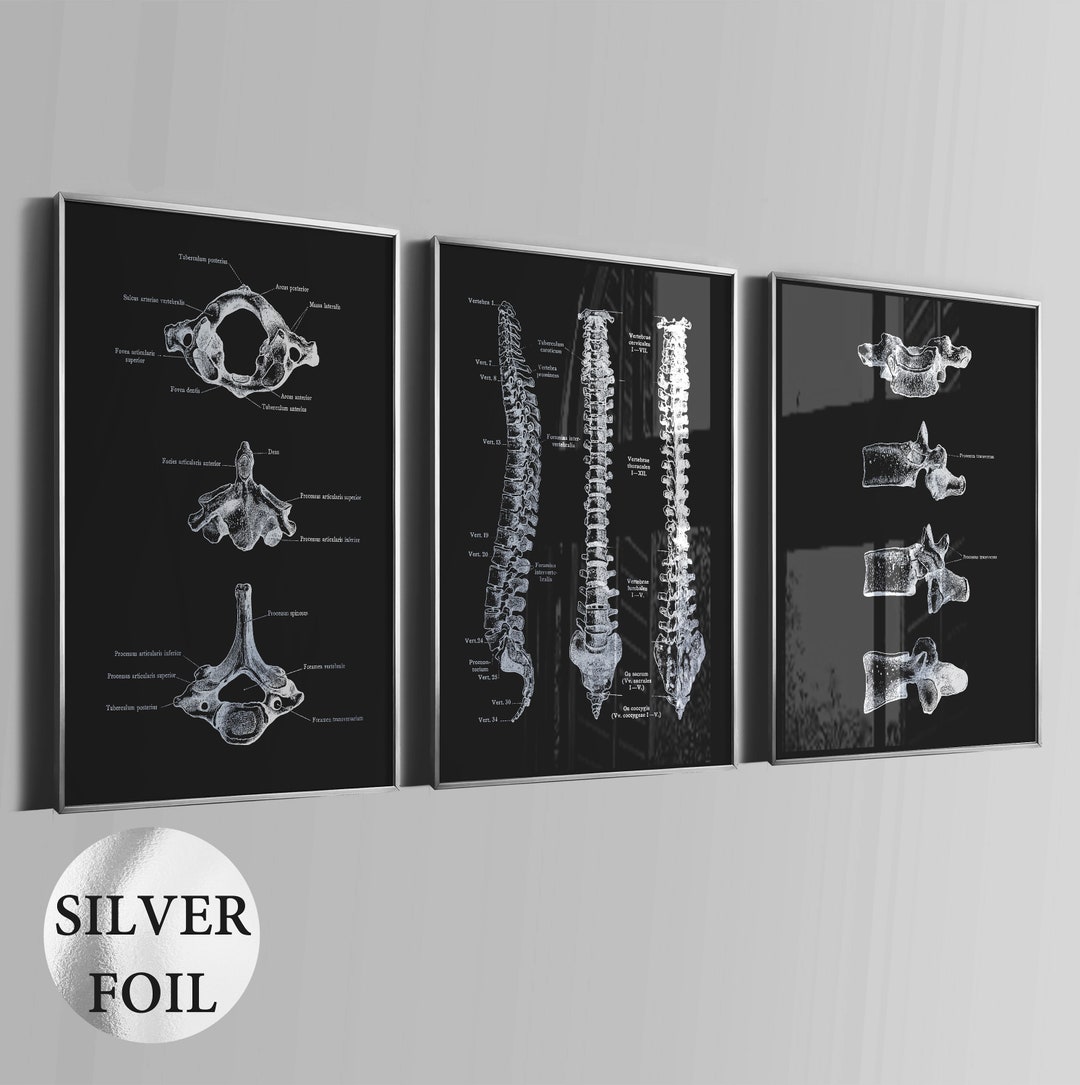 3 Spine Anatomy Prints Vertebral Column Human Spinal Anatomy Medical ...