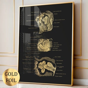 6 Human Ear Anatomy Art Audiology Poster Gold Medical Art Inner Ear ...