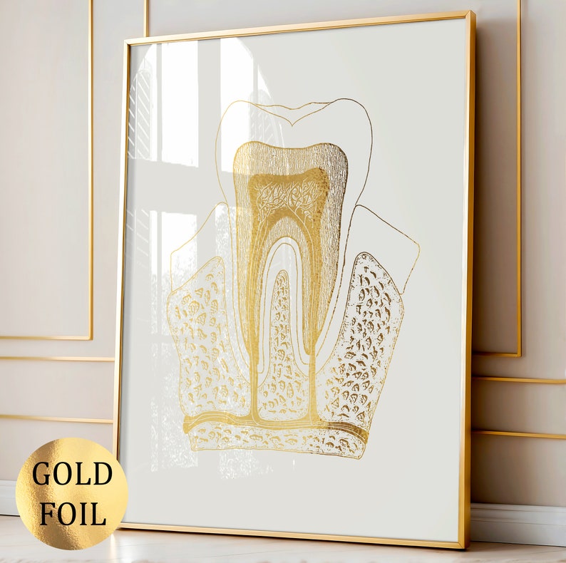Set 6 Tooth Anatomy Art Dental Medicine Poster Tooth Diagram Teeth ...