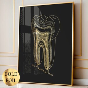 6 Tooth Anatomy Posters Dental Art Tooth Grow Diagram Teeth Types ...