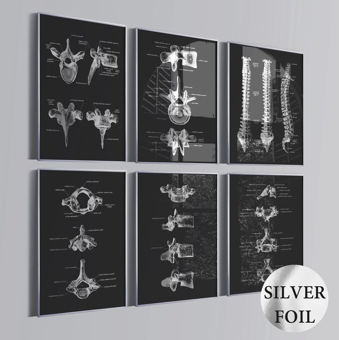 6 Human Spine Anatomy Print Vertebral Column Anatomy Art Vertebrae ...