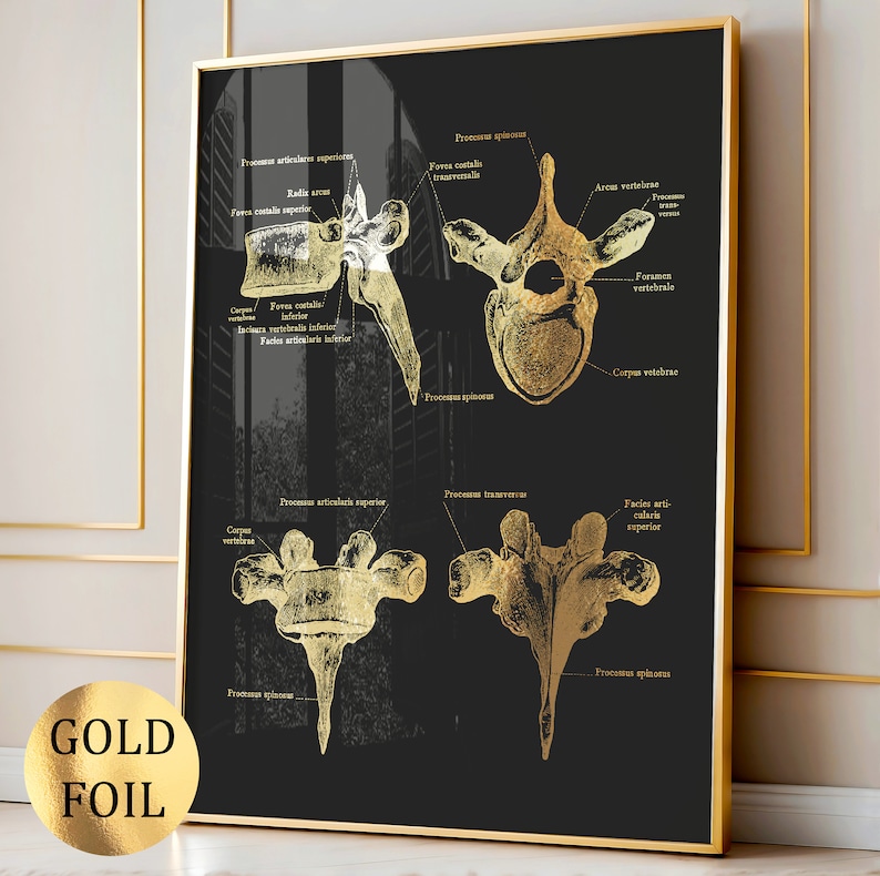 6 Spine Vertebral Column Anatomy Art Vertebrae Poster Spinal Diagram ...