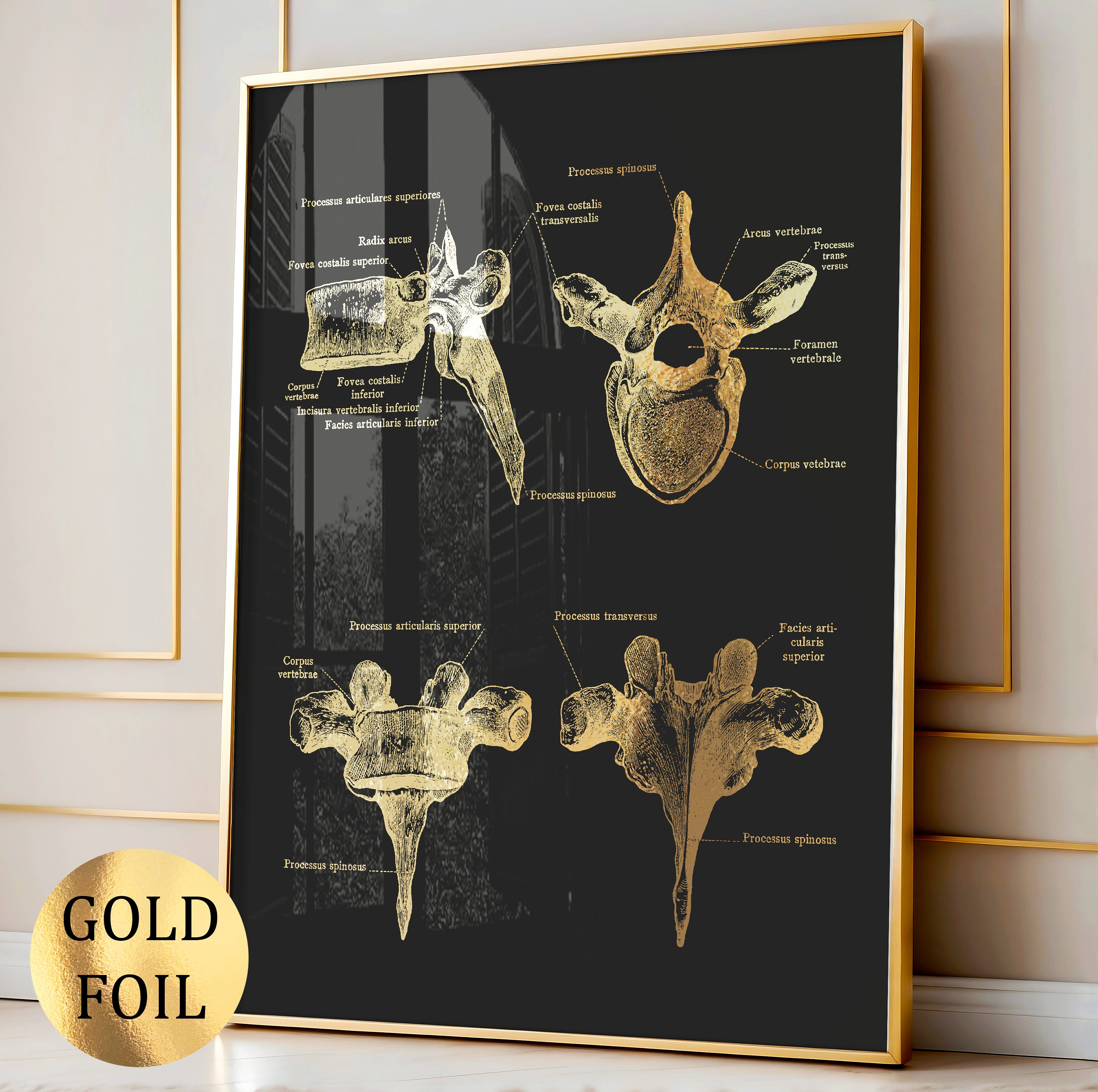 6 Spine Vertebral Column Anatomy Art Vertebrae Poster Spinal Diagram ...