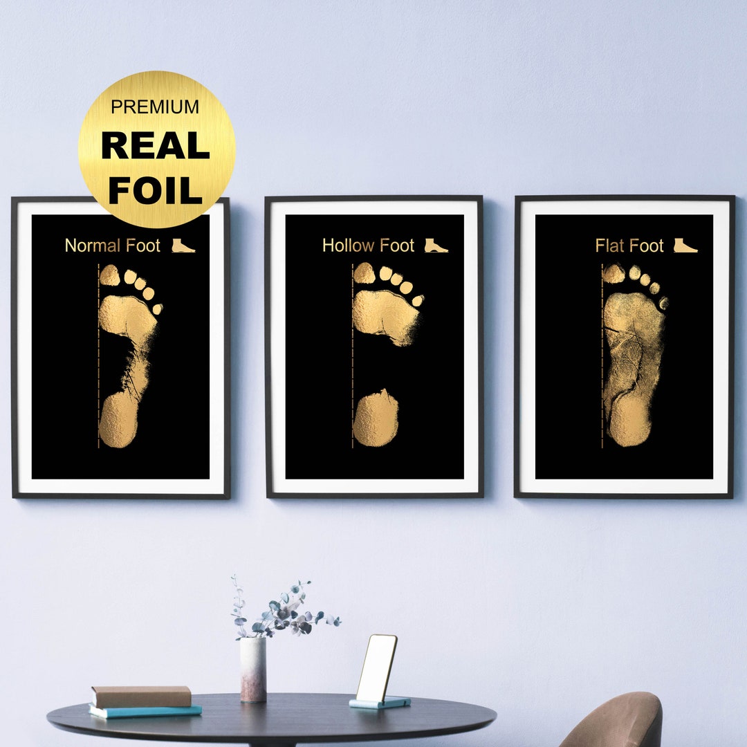 3 Gold Footprint Types Art, Anatomy Art, Foot Pathologies, Foot Arch ...