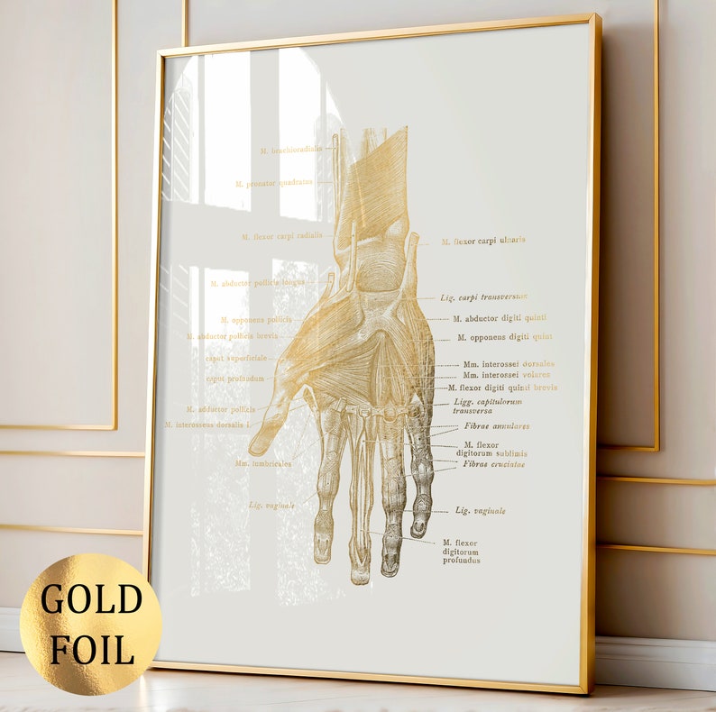 Set 6 Hand Anatomy Art Orthopedic Poster Medical Art Hand Diagram Wrist ...