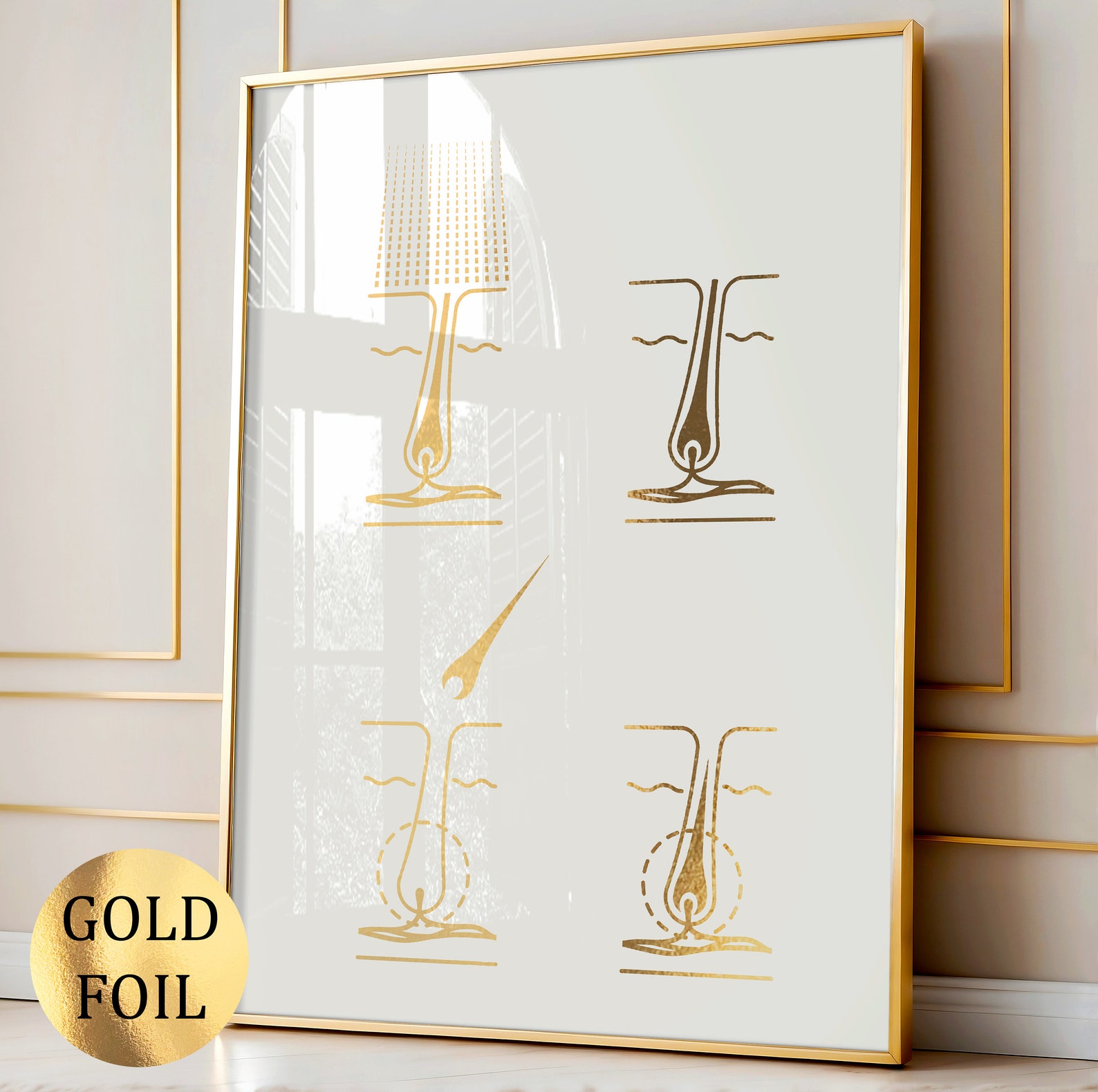 6 Laser Hair Removal Posters Beauty Treatment Art Gold Foil Print Med ...